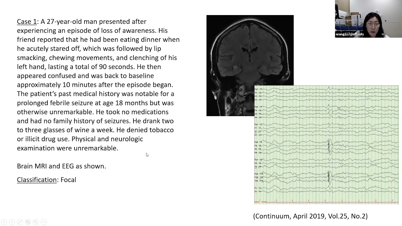 Epilepsy Lecture