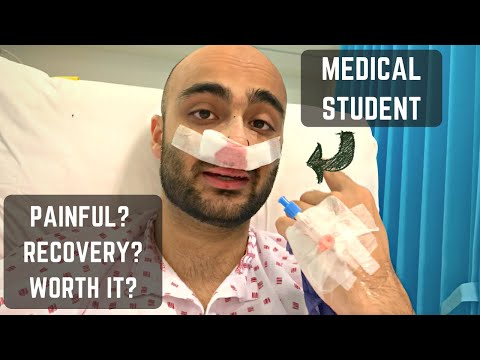 Underwent surgery 3 days before med school finals | Septoplasty VLOG + Advice