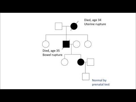 E04.2 Vascular Presentation of the Ehlers Danlos Syndromes