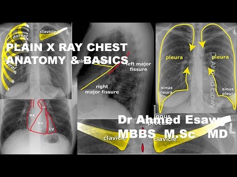 PLAIN X RAY CHEST ANATOMY & BASICS (VIDEOBOOK)