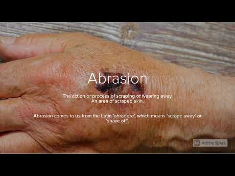 Learn English Vocabulary - Nouns starting with 'A' - 5 words for today