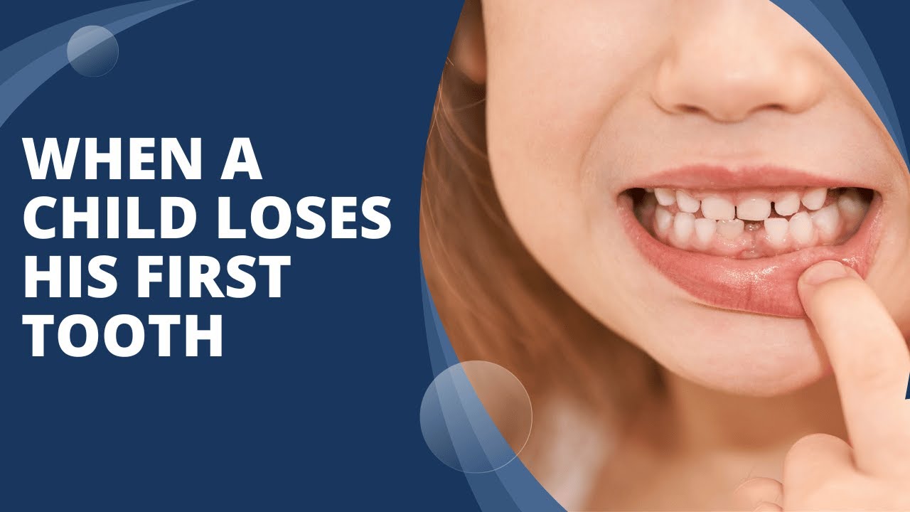 When a Child Loses His First Tooth: Best Helpful Aftercare Tips