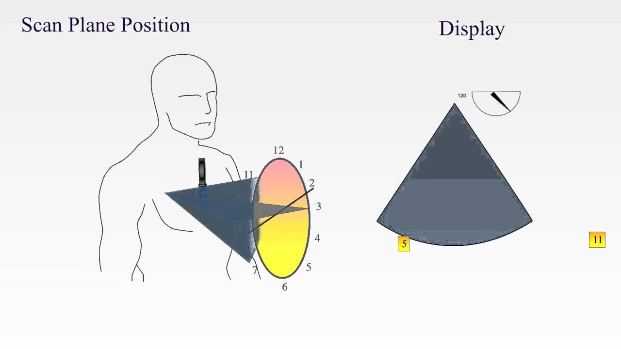 2 TEE Imaging Planes and Orientation