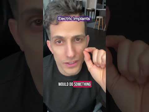 Is electric implants a thing?