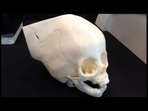 3 D Printed Medical Devices at MD&M East and Atlantic Design & Manufacturing