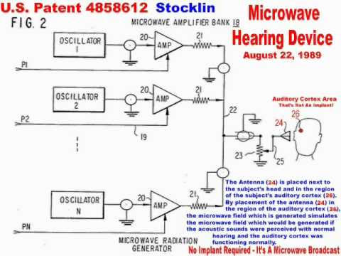 Microwave auditory effect | Brain Control Hedge