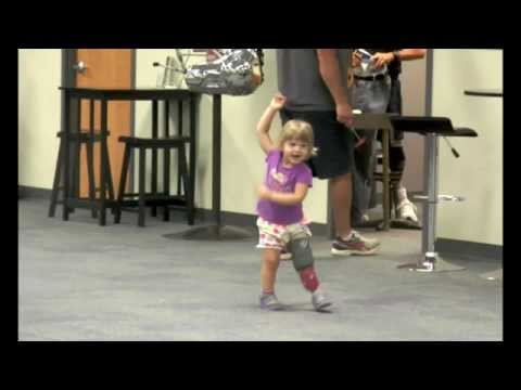 Knee Prosthesis - Kids Prosthetic Leg In Delhi NCR Manufacturer from Rohtak