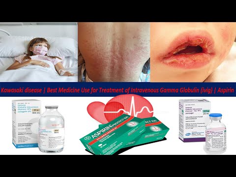 Kawasaki disease | Best Medicine Use for Treatment of Intravenous Gamma Globulin (IVIG) | Aspirin