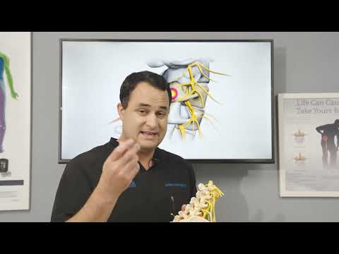 What is Radio Frequency Ablation (RFA)?