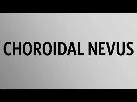 How to pronounce choroidal nevus