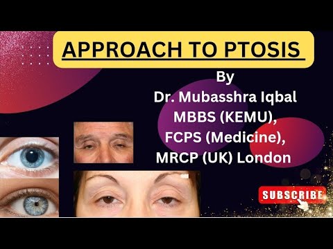 Diagnostic Approach to Ptosis | Ptosis (drooping of upper eyelids) Etiology, Diagnosis, Treatment