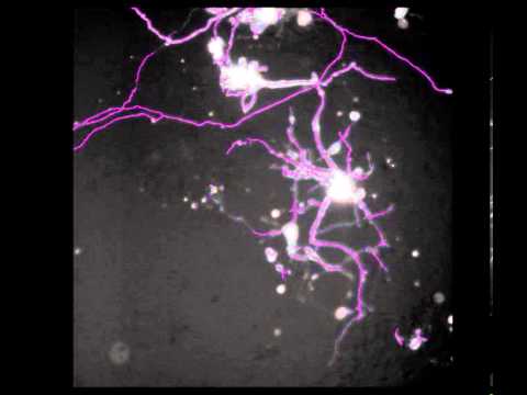 Dendrite detection - Prof. James Ellis (Hospital for Sick Children-Toronto) and CCRM