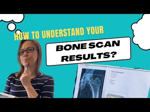 DEXA scan - understand your results with our Physio Led Pilates Expert - Osteoporosis