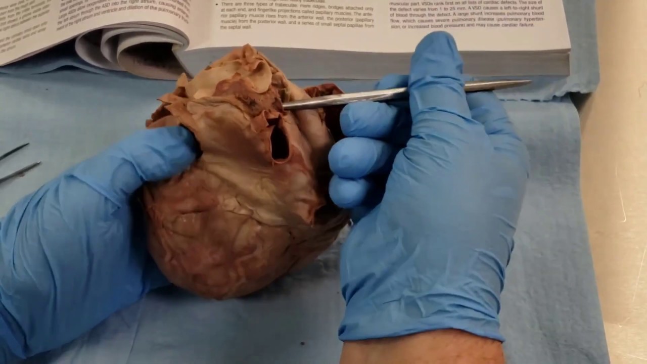External and Internal Features of the Heart