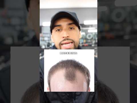Top 3 Hairstyles for a Receding Hairline!