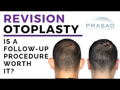Why Reshaping the Cartilage is Important in Cosmetic Ear Surgery to Prevent Regression