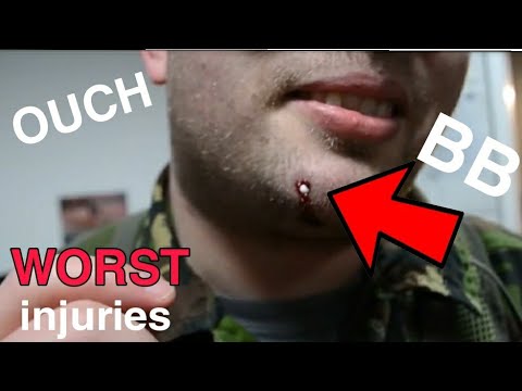 *WORST* AIRSOFT INJURIES - AirsoftJudge.com