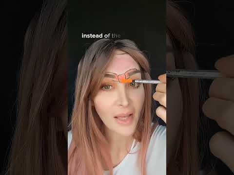 Heavy Brows After Frown Line Botox