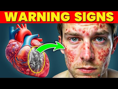 13 Skin Signs of SERIOUS Heart Problems