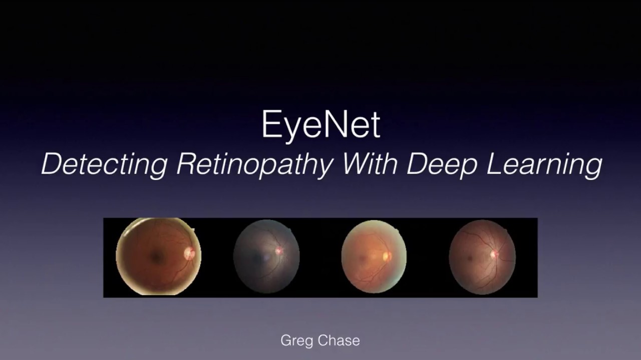 Revolutionizing Diabetic Retinopathy Detection with EyeNet and Deep ...