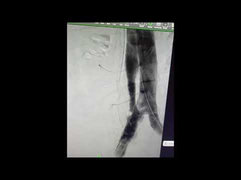 Interesting angiograms