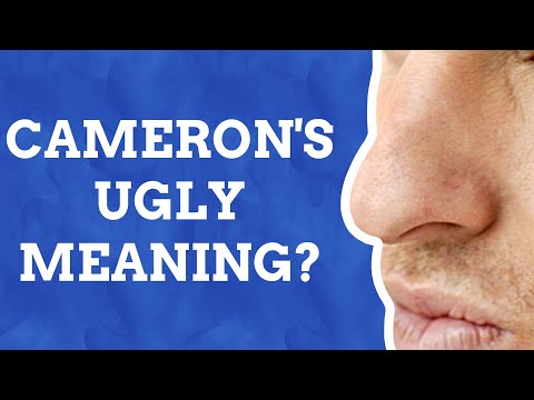 Does The Name Cameron Mean You’re Ugly?