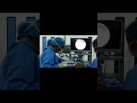 Arthroscopic ACL reconstruction of knee for Sports Injury