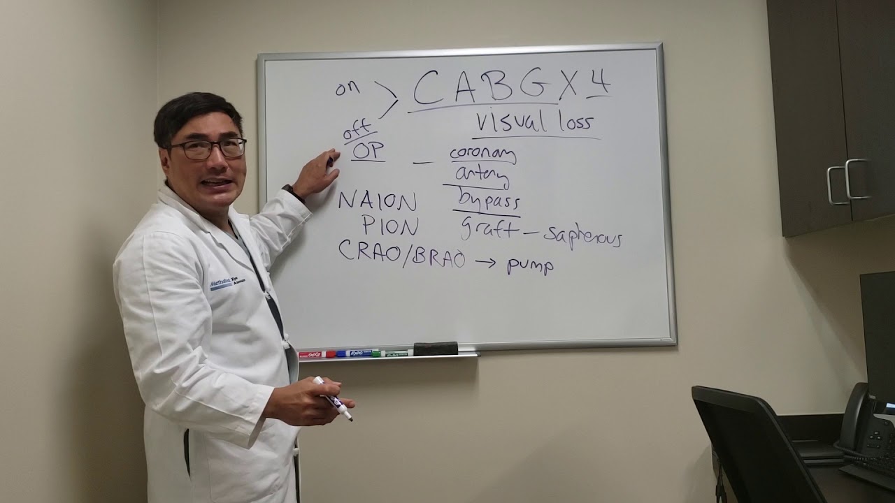 CABG-related Vision Loss