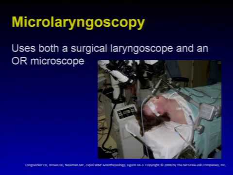 Otorhinolaryngology ENT Anesthesia