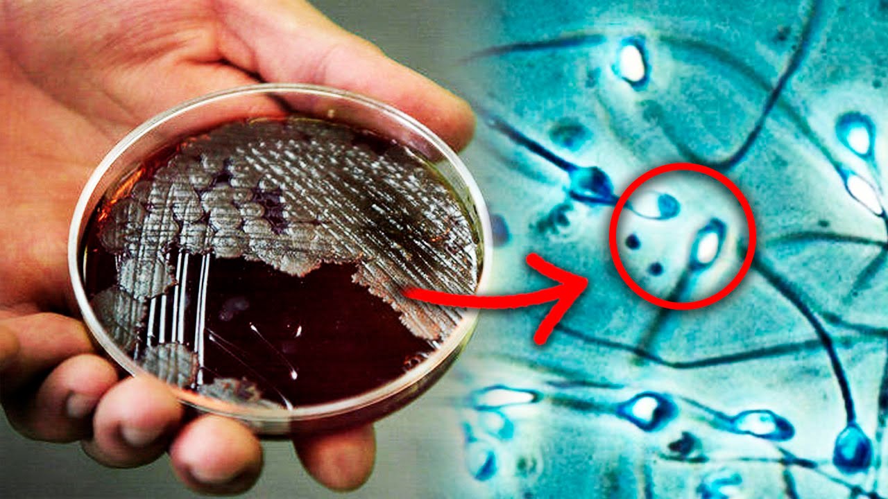 Crean Espermatozoide Funcional en Laboratorio - Gran Avance Cientifico