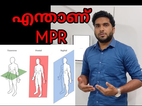episode 8 what is MPR ?