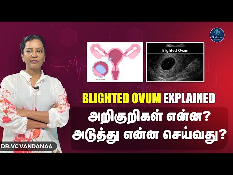 Blighted ovum explained! | அறிகுறிகள் என்ன?