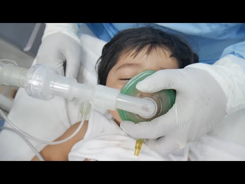 Baby Getting Anesthesia for Surgery