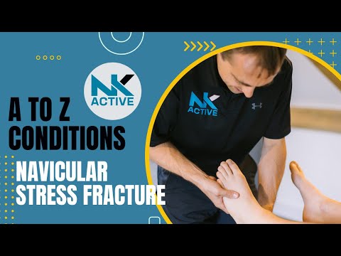 A to Z - Navicular Stress Fractures