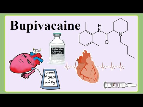 bupivacaine