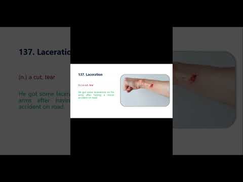 137. Laceration- Visual English Vocabulary in Urdu/Hindi #shorts #englishvocabulary #visuallearning