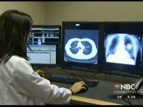 Using CT Scans to Screen for Lung Cancer