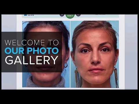 Welcome to Our Photo Gallery