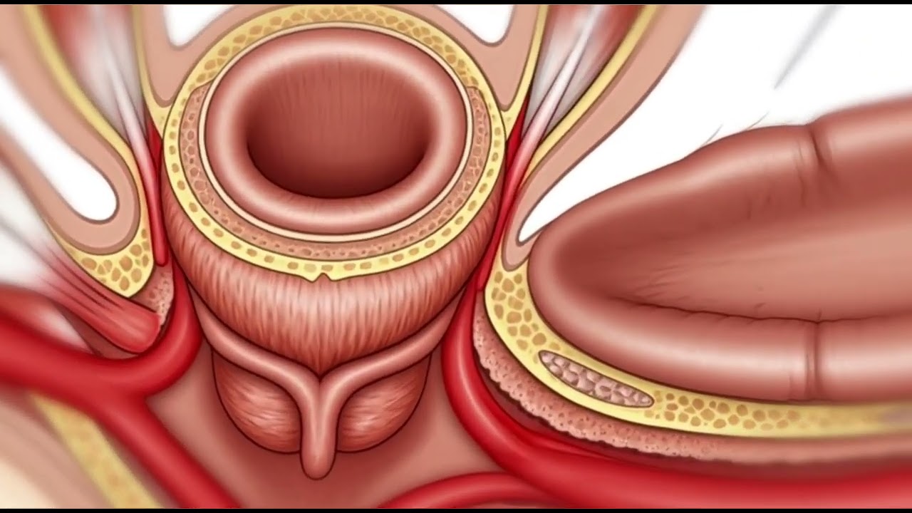 What Happens Inside the Body During Anal Intercourse? | Medical 3D Anatomy Explained Male Pelvic