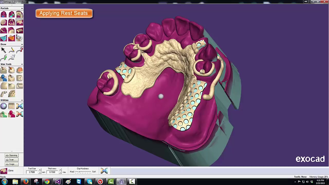 exocad Technology Preview  Partial Framework Design