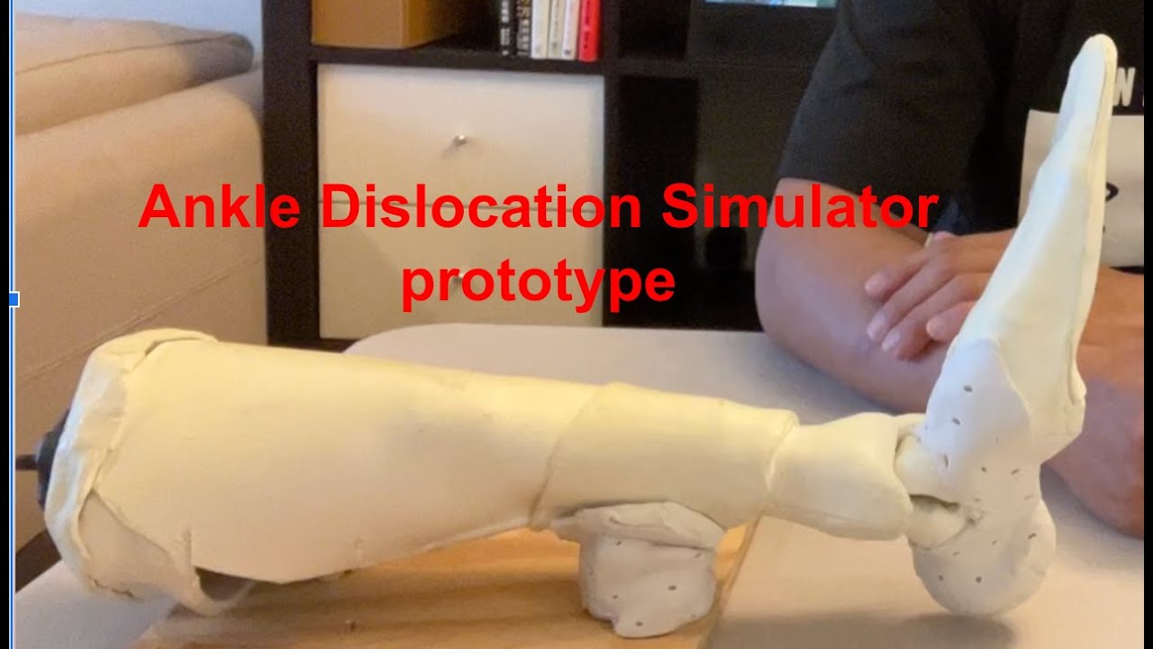 Reduction technique demo on ankle dislocation | Sports Medicine | Athletic Training |