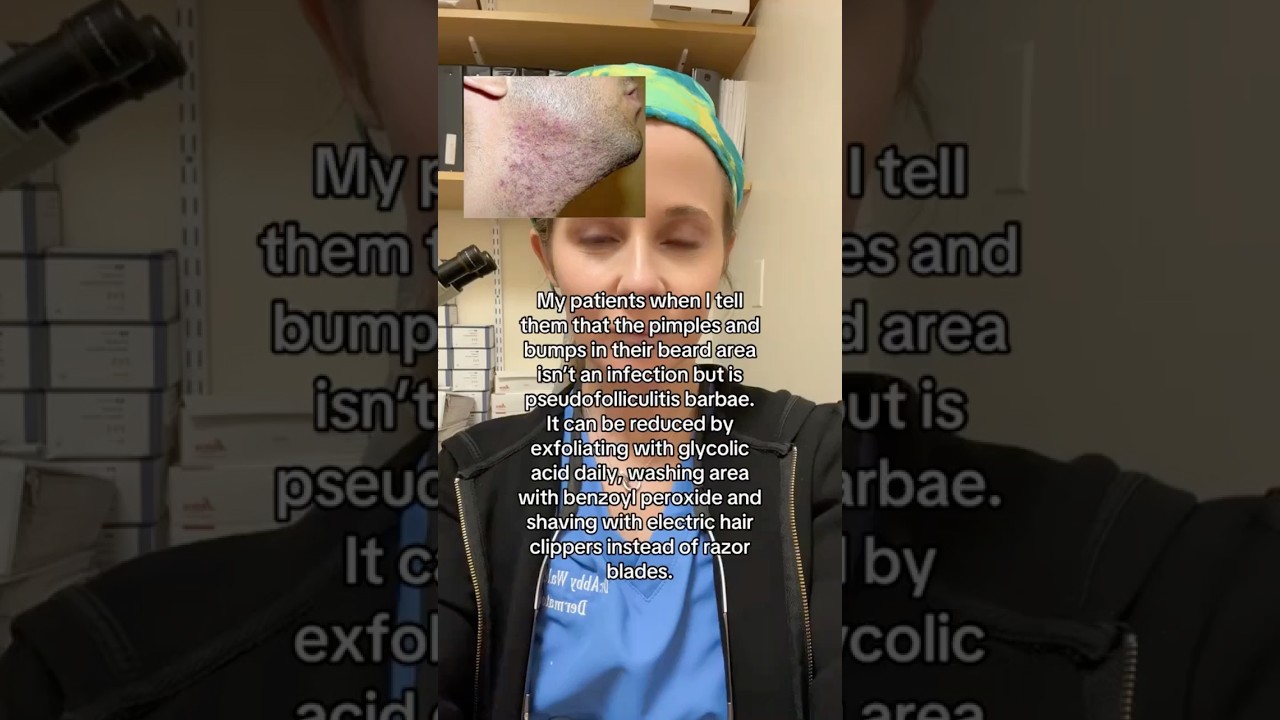 Do you or someone you know get ingrown hairs in the beard area known as Pseudofolliculitis barbae?