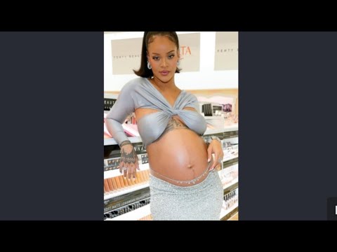 Linea Nigra//Striae Gravidarum//Sign of Pregnancy
