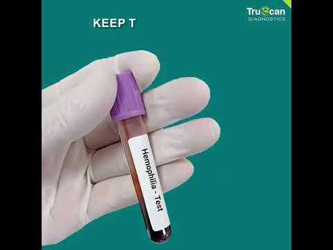 KEEP TRACKING YOUR PLATELET COUNTS | #platelets #truscandiagnostics