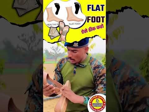 army medical test | Flat foot कैसे ठीक करें ? ssc gd medical #flatfoot #armymedical #sscgdmedical