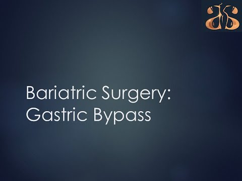 Bariatric Surgery: The Roux-en-Y Gastric Bypass
