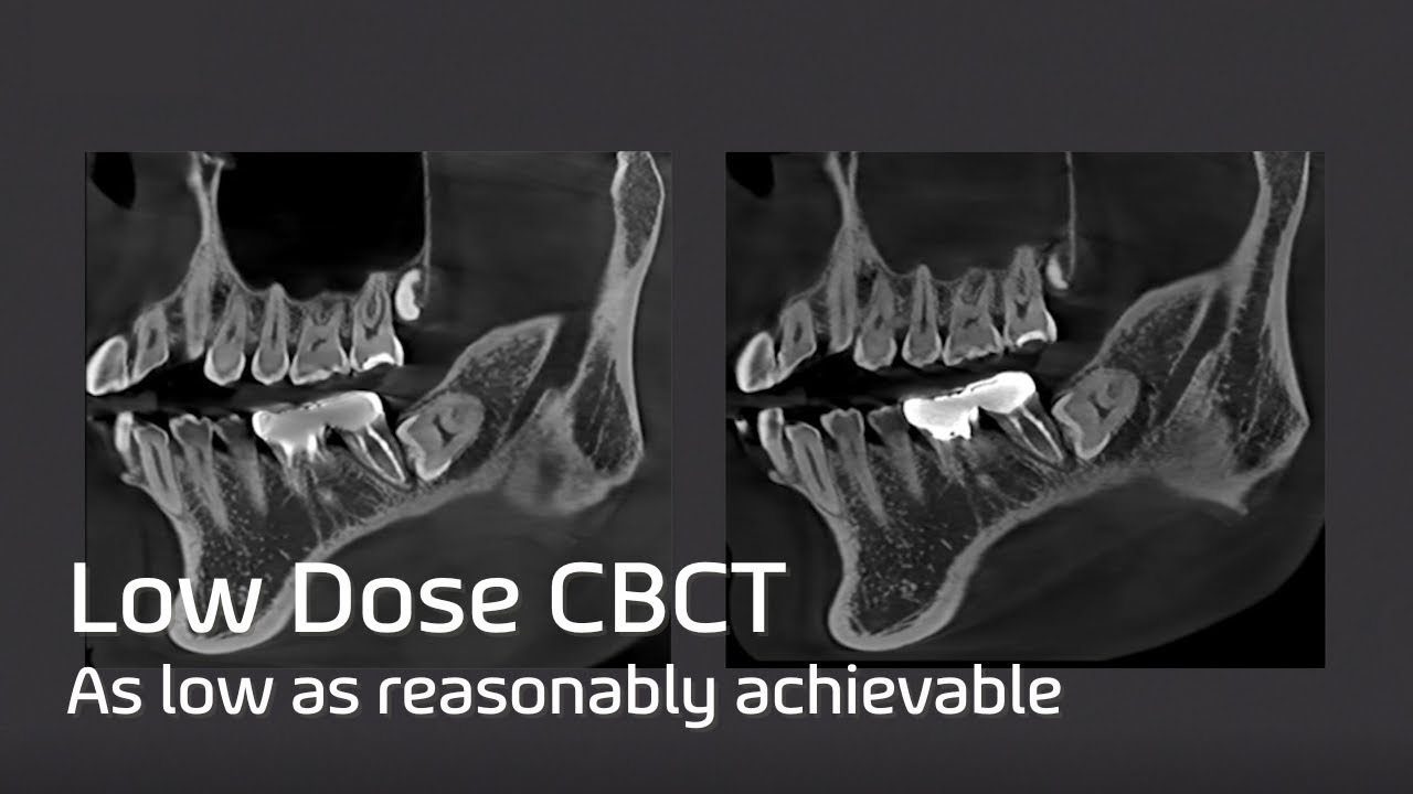 The Science of Low Dose: Vatech CBCT Proven Results