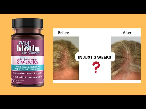 My Biotin Pro Clinical: Don't Buy Until You Know This