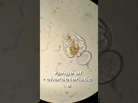 Brachionus Diversity: the Astonishing Variety of Microscopic Rotifers!