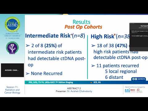 Part 2 - Detectable HPV ctDNA in Post-Operative Oropharyngeal Squamous Cell Carcinoma - Dr Avishek